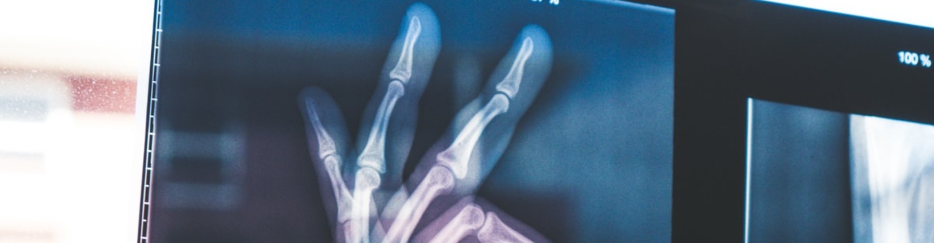 Radiologic Technologist Resume [X Ray Tech Resume Example]